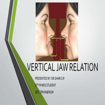 vertical jaw relation | PPTX