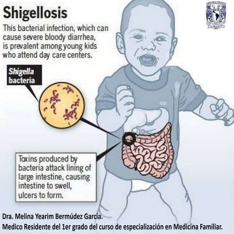 Shigelosis | PPT