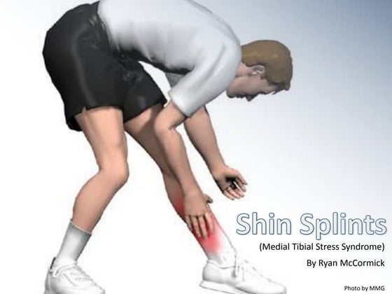 Shin splints powerpoint | PPTX | Bone and Joint Conditions | Diseases ...