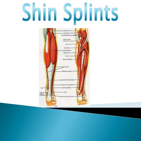 Shin splints powerpoint | PPTX