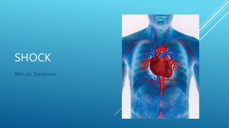 Shock, tipos, tratamientos, manejo