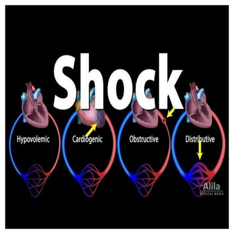 Pathology and Pathophysiology of Shock | PDF