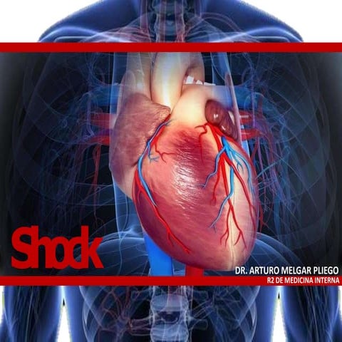 TIPOS DE SHOCK, HIPOVOLEMICO, CARDIOGENICO, DISTRIBUTIVO, ETC | PPTX