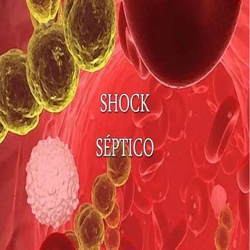 Shock septico | PPTX