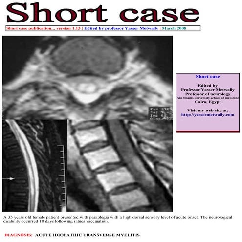 Short case...Acute postinfectious transverse myelitis | PDF