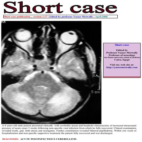Short case...Postinfectious cerebellitis | PDF