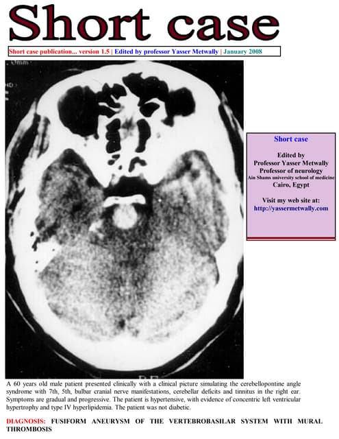 Short case..Subacute cerebral hemorrhage | PDF