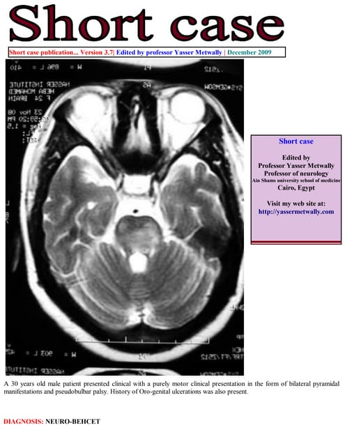 Short case..Subacute cerebral hemorrhage | PDF | Blood Disorders | Diseases and Conditions
