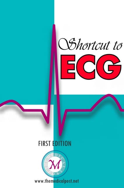 ECG #1 - ID 380 – Normal ECG | PPT