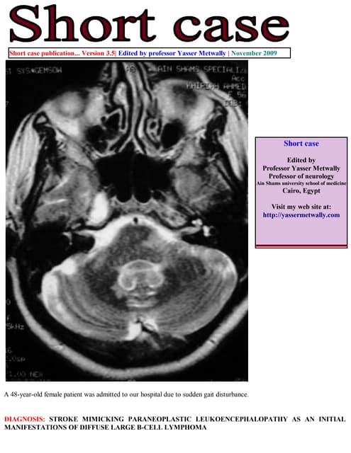 Short case..Subacute cerebral hemorrhage | PDF