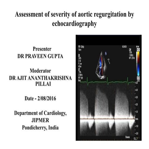 Patent Ductus Arteriosus (PDA) Echocardiographic Assessment: Anatomy ...