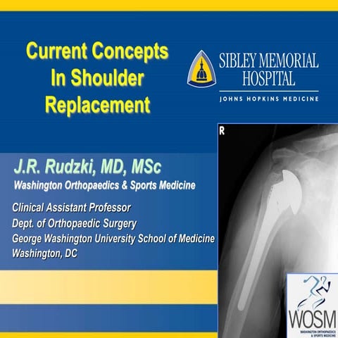 Current Concepts in Shoulder Replacement | PPT