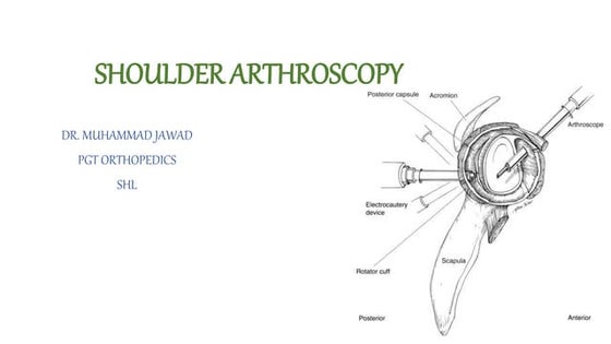 Shoulder arthroscopy | PPTX | First Aid | Injuries