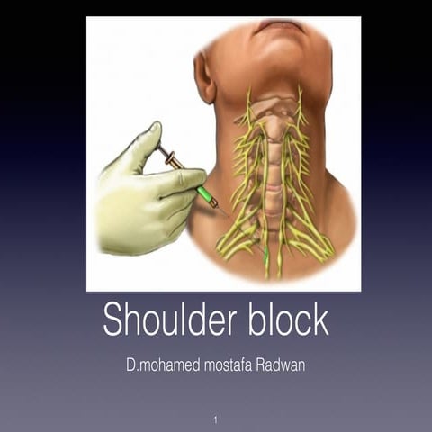 Shoulder block tutorial 2014 | PPT