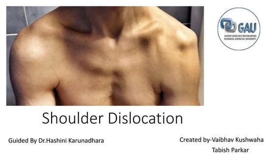 shoulder dislocation.pptx shoulder dislocation is and common scenerio ...