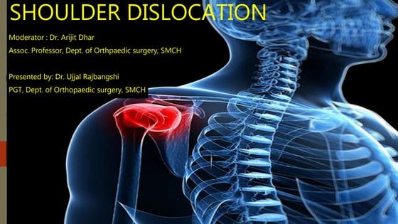 Shoulder Dislocations | PPT