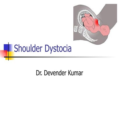 Shoulder Dystocia | PPT