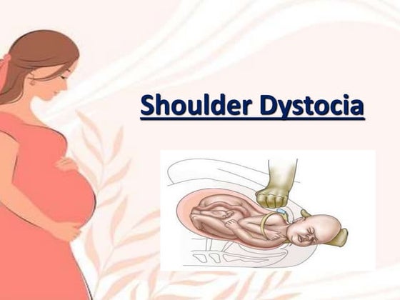 SHOULDER DYSTOCIA.pptxgghhhhhggggggggggggg | PPT