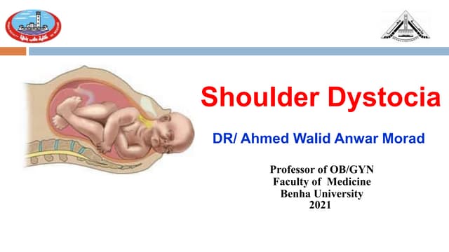 Shoulder dystocia