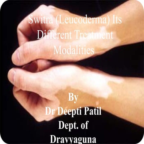 SHWITRA (vitiligo) white discoloration.pdf