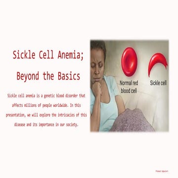 SICKLE CELL ANEMIA.pptx