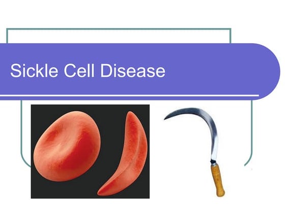 Sickle cell disease | PPT