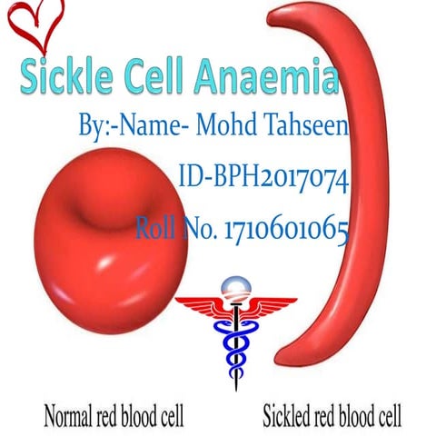 Sickle Cell Anaemia Pptx 9283