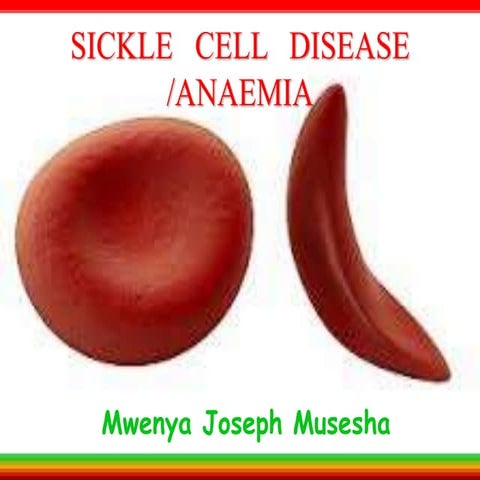 Sickle Cell Anaemia Types And Management Ppt