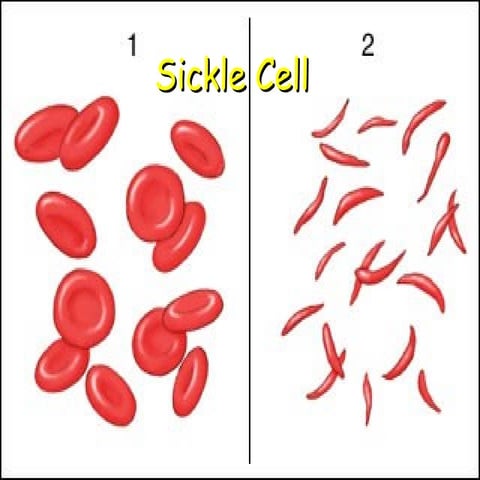 Sickle Cell and ESR laboratory methods.ppt