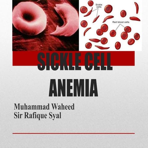 Sickle cell anemia by waheed | PPTX