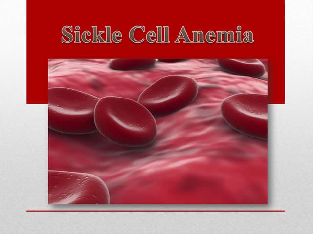 Sickle cell anemia | PPTX