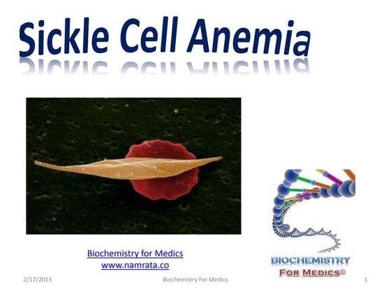 Sickle cell anemia | PPTX