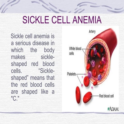 Sickle cell anemia