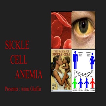 Sickle cell Anemia Diseases . | PDF