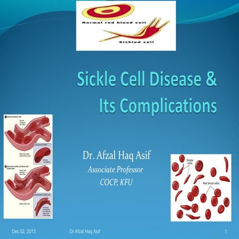 Sickle cell disease.Therapeutics | PPT