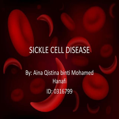 Sickle cell disease | PPTX