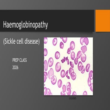 Sickle cell disease | PPTX