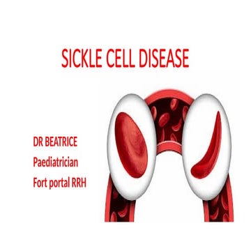 Sickle cell disease | PPTX