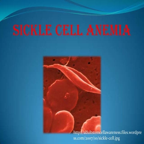 Sickle Cell - Student Presentation | PPTX