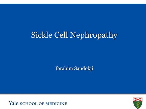 Sickle cell nephropathy SCN | PPT