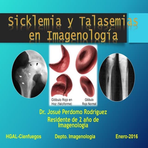 Sicklemia y talasemias en imagenología | PPTX