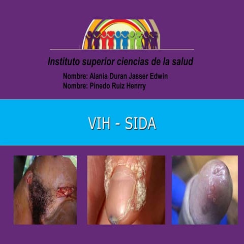 sida-presentacion.ppt