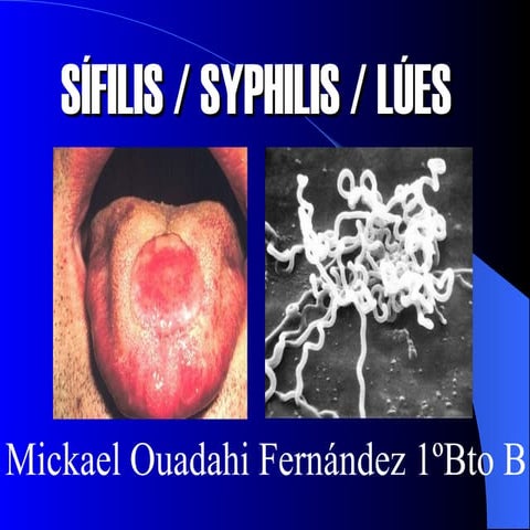 Sifilis enfermedad | DOCX