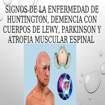 Enfermedad de huntington | PPTX