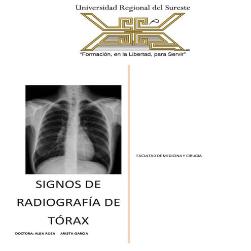 Signos radiológicos de edema pulmonar | PPTX