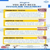 Signs You May Need Invisalign Treatment .pdf