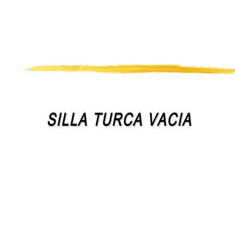 Silla turca vacia | PPT