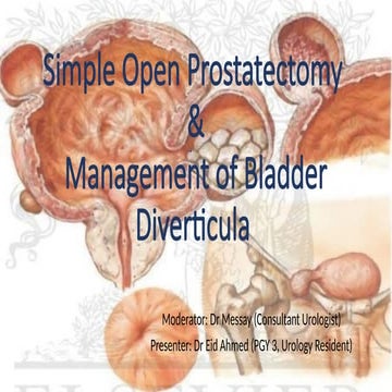 Supra pubic cystostomy | PPTX