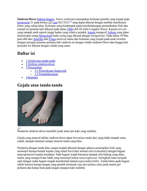 Down Sindrom PPT | PPTX