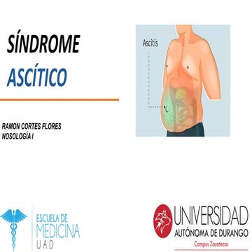 Sindrome ascitico edematoso, diagnostico y tto | PPTX